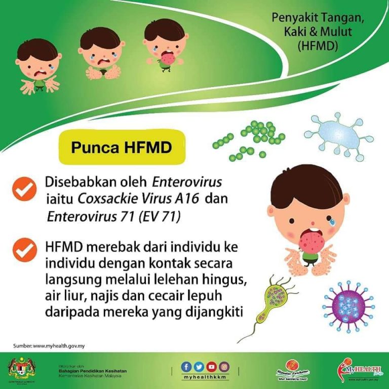 Cara Atasi dan Elakkan Penyakit HFMD - Kak Yan Cakap