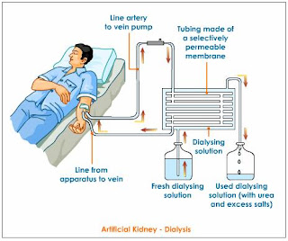 MY SCIENCE LABORATORY TECHNOLOGY: Dialysis as a biochemical procedure