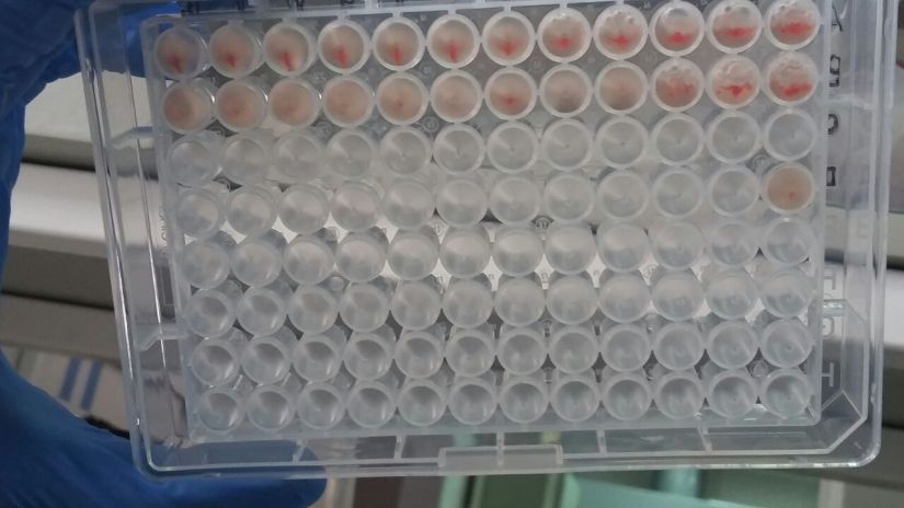 Cara-Cara UJI HA Dan HI Yang Praktis dan Mudah Dipahami