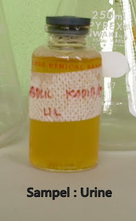 Pemeriksaan Urinalisis Lengkap | Analis Kesehatan