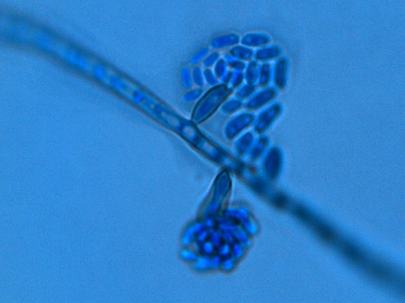 Fun With Microbiology (What's Buggin' You?): Exophiala dermatitidis