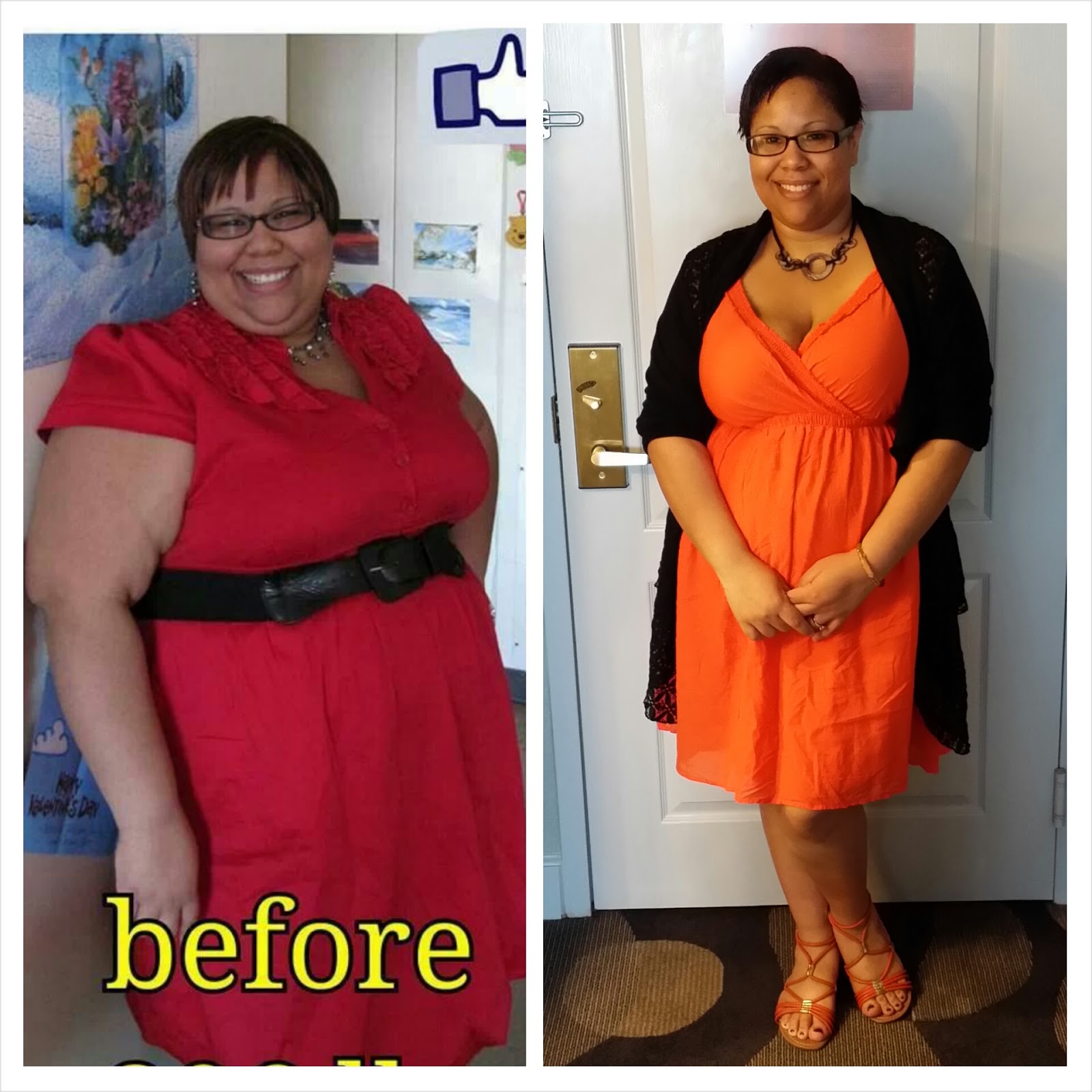 My Journey through Roux-En-Y Gastric Bypass Surgery: 6 months, 102 ...