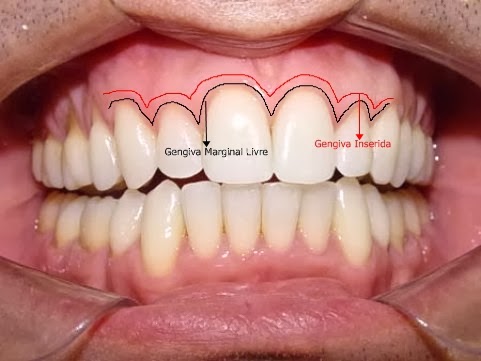 Sobre a Saúde Bucal.