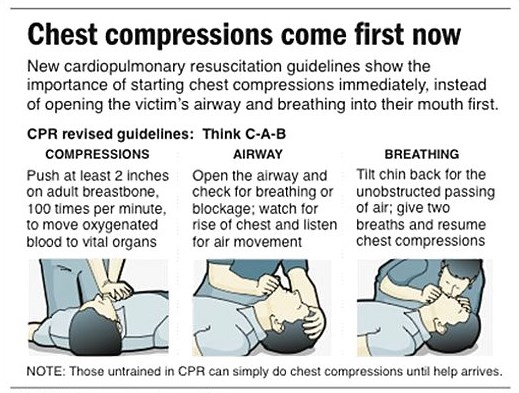 Stages Of Cardiac Pulmonary Resuscitation And The Advantage Of Being ...