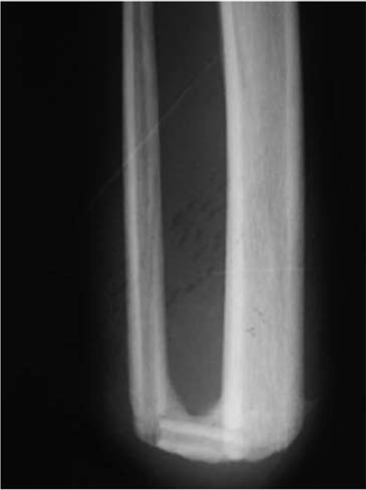 One Foot Forward: Saturday (7/30/2016)