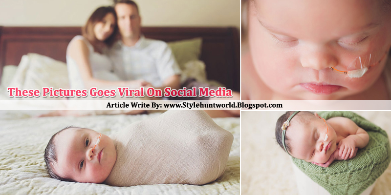 This Baby Girl Has An Inoperable Brain Tumor, The Rare Pictures Of This ...