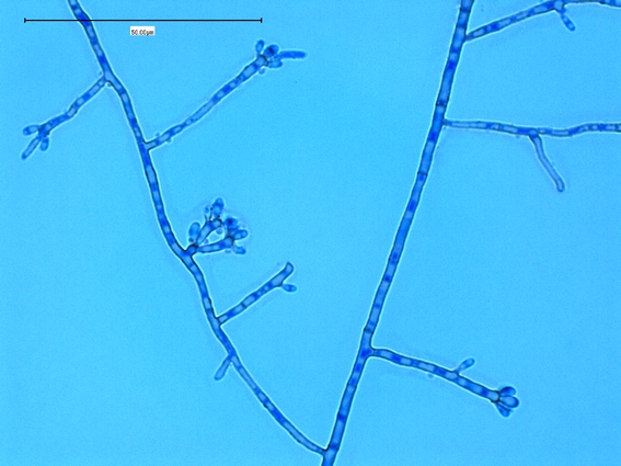 Fun With Microbiology (What's Buggin' You?): Fonsecaea pedrosoi/monophora