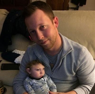 Photos: Jaxon Buell Strong, Baby Born With Half Skull Marks 2nd ...