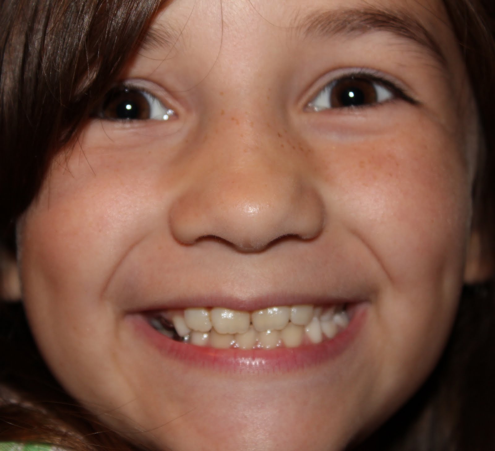 Living 2014: Bonus - The Dimple War