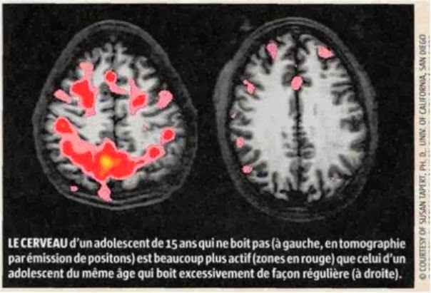 Les Addictions: février 2014