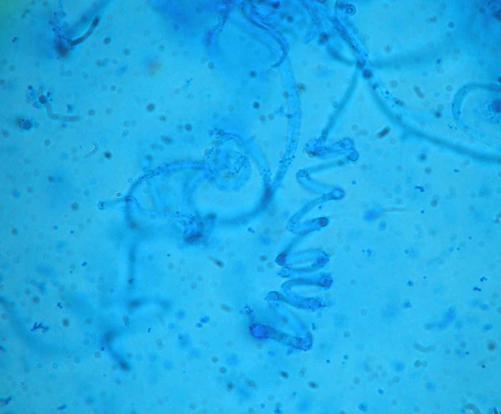 ATLAS MICOLOGIA: TRICHOPHYTON MENTAGROPHYTES