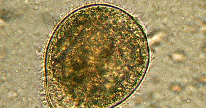 DIAGNOSIS OF BALANTIDIUM COLI AND PRASMODIUM SPECIES