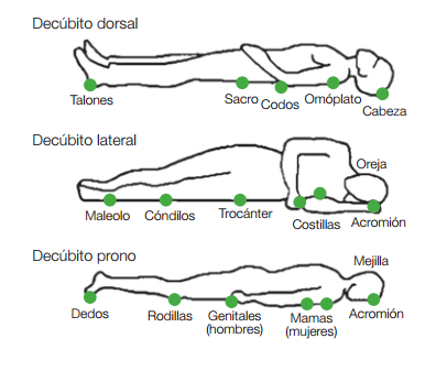 Emergency Team : Prevención y aparición de úlceras por presión