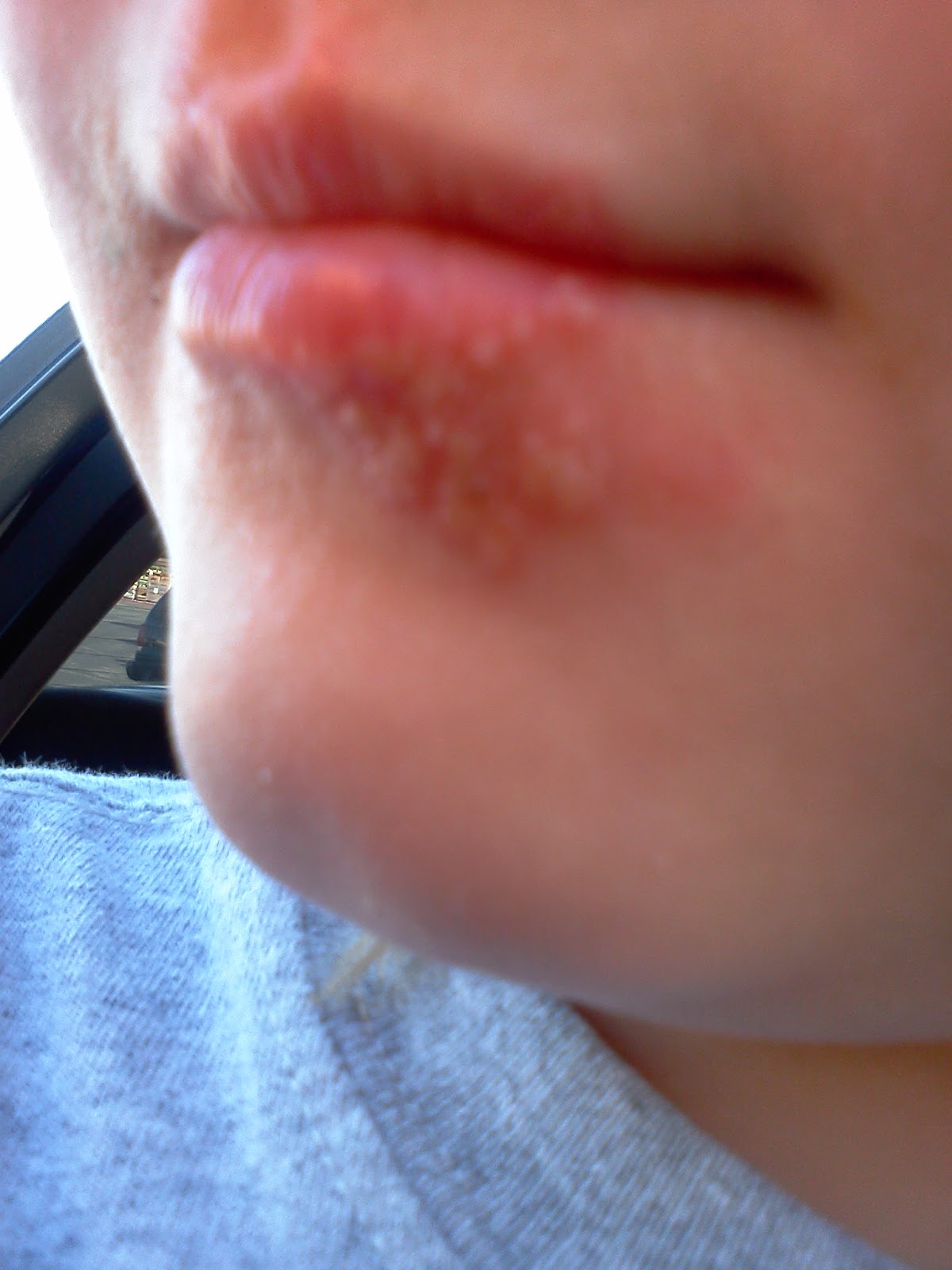 Life with Lupus: DJ's battle