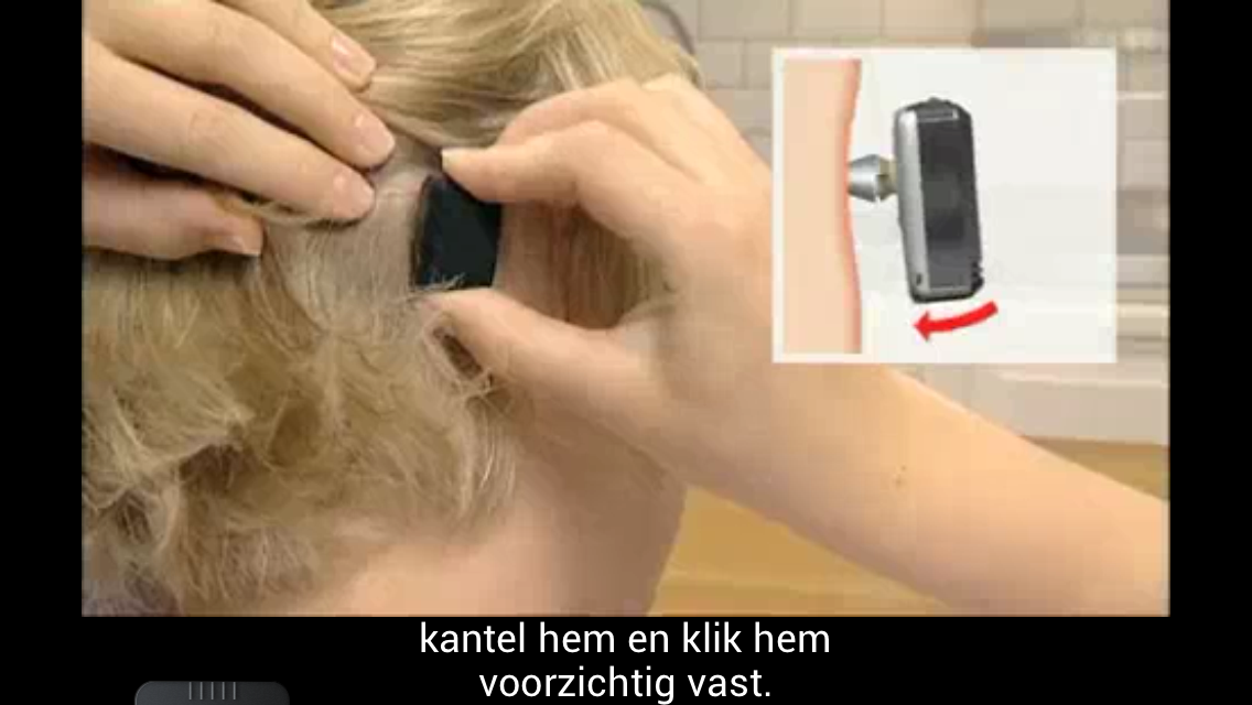 Review: Cochlear Baha Support-app - Dutch-Tech Magazine