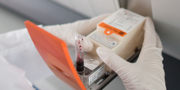 Medical Laboratory and Biomedical Science: T2Candida Panel - A Blood ...