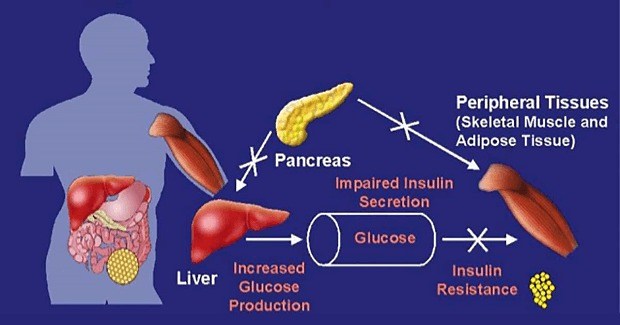 3 Important Things Every Diabetic Should Know About!