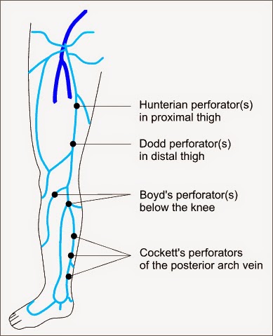 Medical Student Sharing: Varicose Vein and Examination