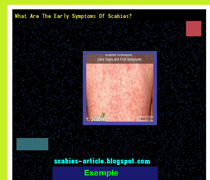 What Are The Early Symptoms Of Scabies? - Scabies Article