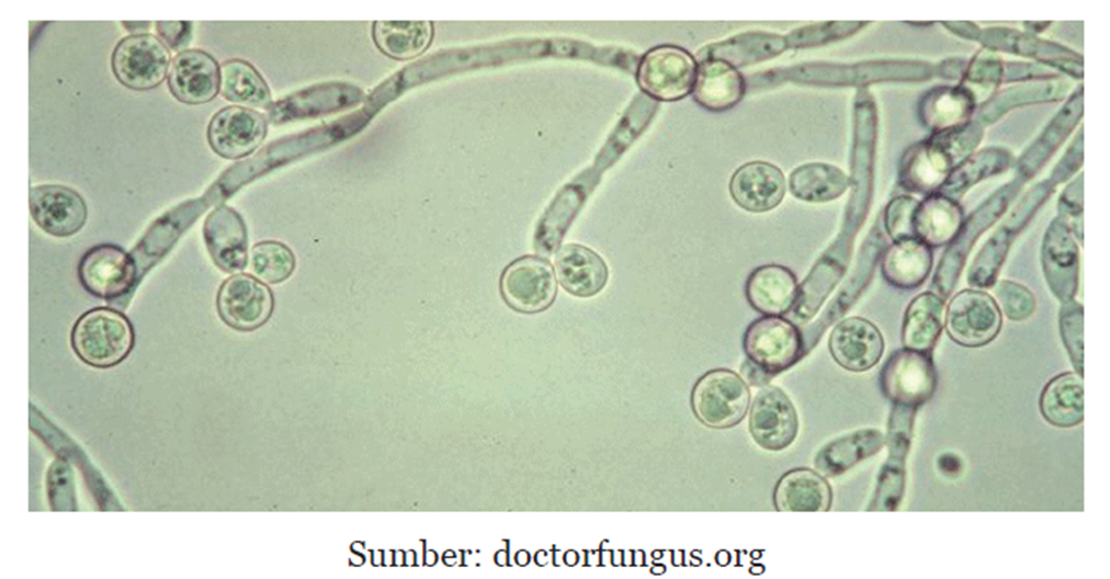 Jamur Candida Albicans - Perumperindo.co.id