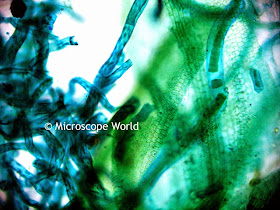 Microscope World Blog: Moss Under the Microscope