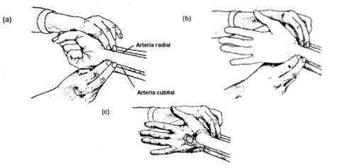 Test de Allen | APUNTES AUXILIAR ENFERMERIA
