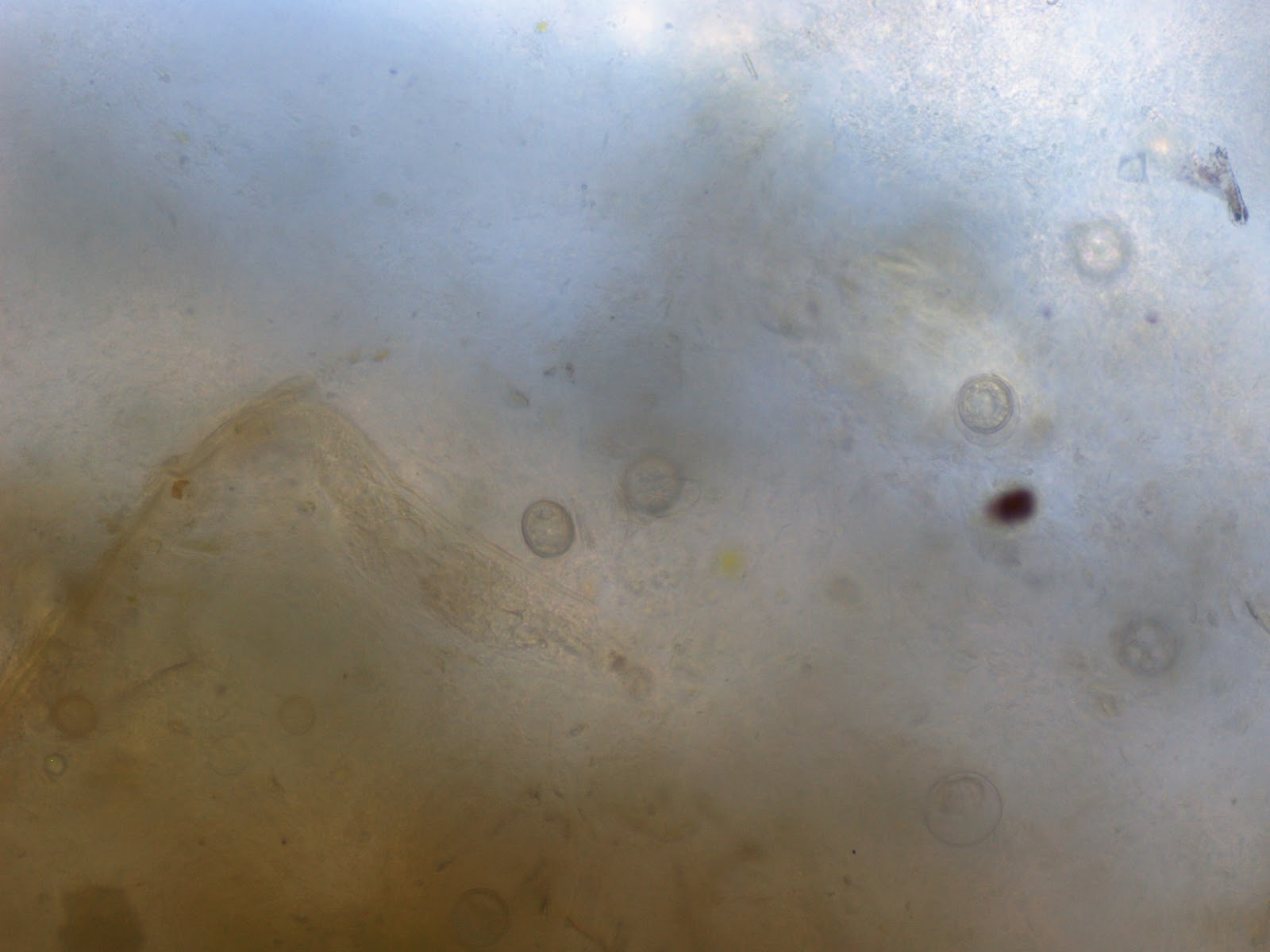 University of Illinois Plant Clinic: Pythium Damping-off at the Soil ...