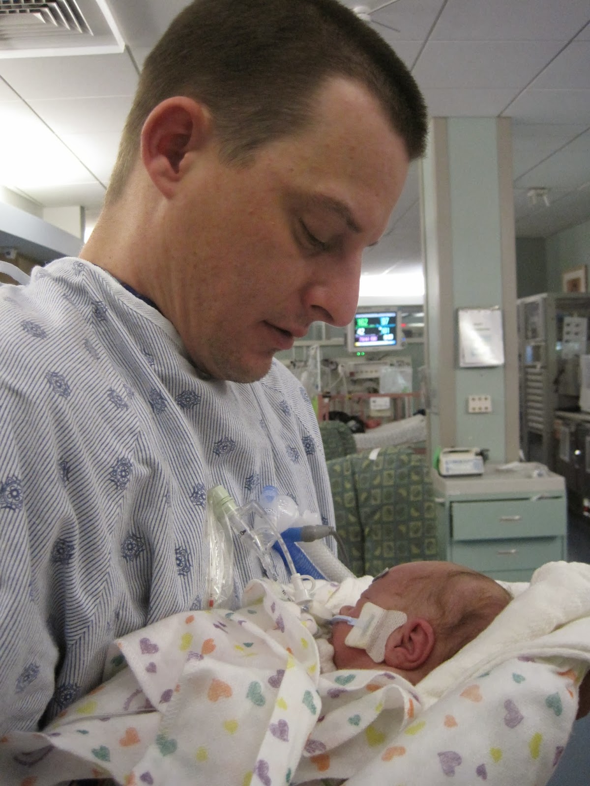 journey of a heart baby: Surgery Day and recovery