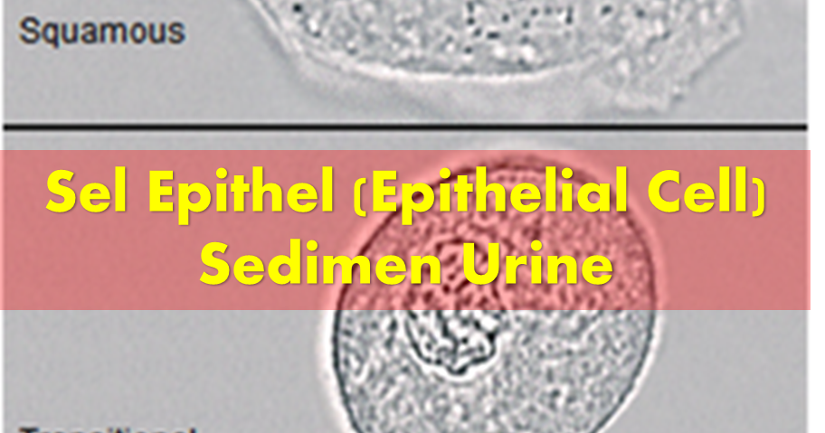 Sel Epithel (Epithelial Cell) Sedimen Urine - Seri Edukasi Teknologi ...