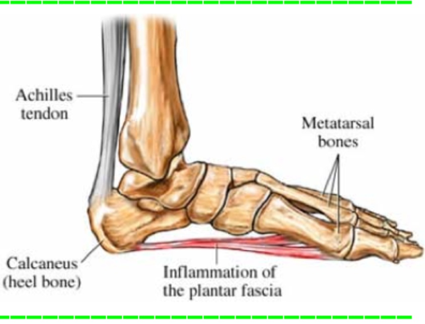 Vampiro Erudito: Calcáneo