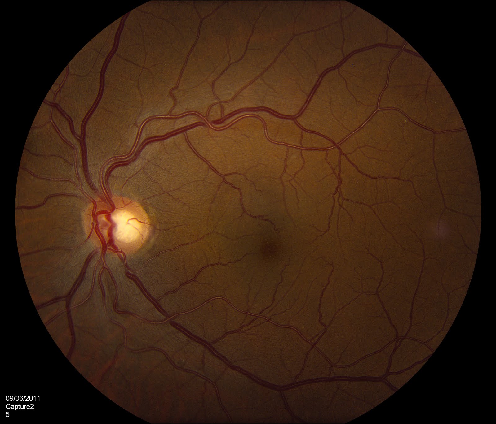 FUNdus exams: What's this?