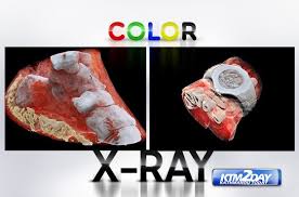 COLOR X-RAYS OF HUMAN BODY ARE REALLY AMAZING - Technology and Tricks