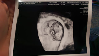 Just Relax and It Will Happen: 8w5d - First OB Appointment and Ultrasound