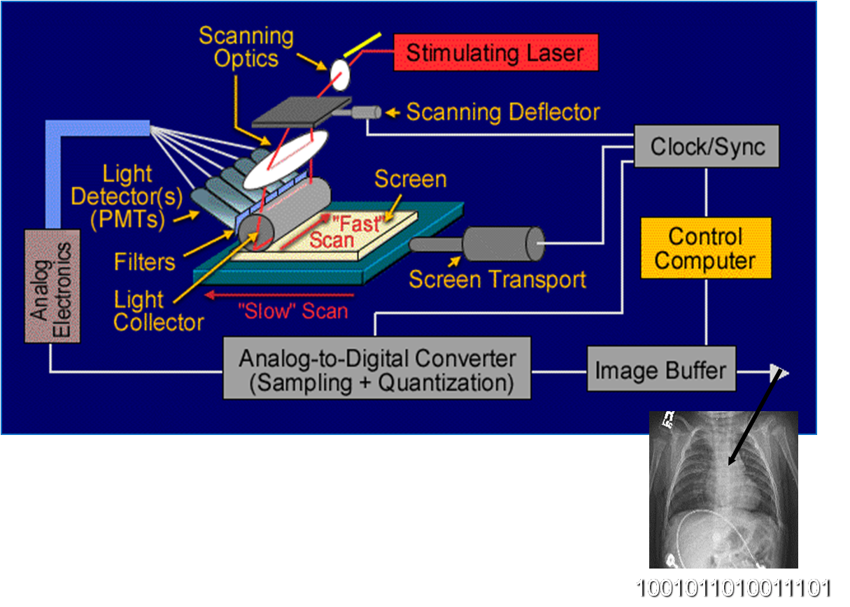 Cafe Radiologi: Instrumen CR (Computed Radiology)