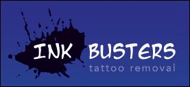 Affordable At Home Tattoo Removal