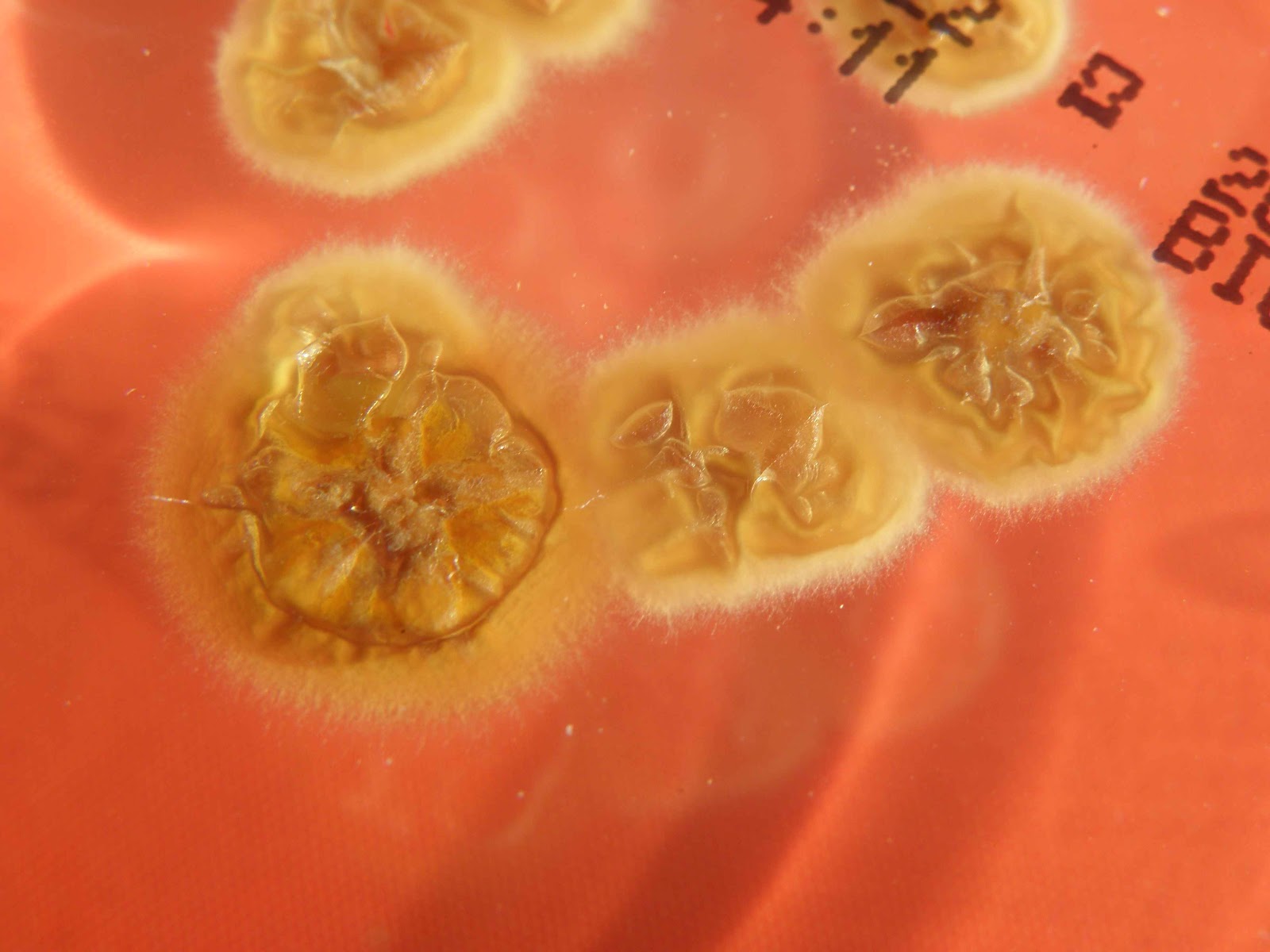 ATLAS MICOLOGIA: EPIDERMOPHYTON FLOCCOSUM