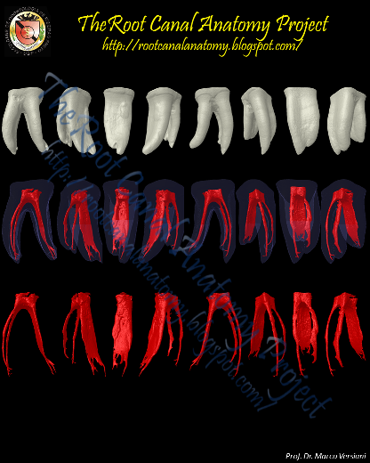 The Root Canal Anatomy Project: Mandibular First Molar