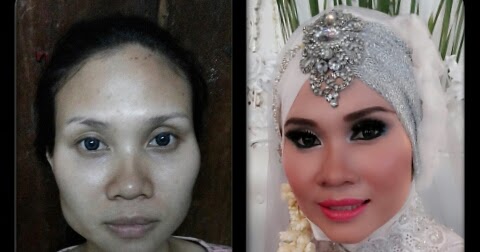 CONTOH AFTER BEFORE | (example: ZoomTemplate)