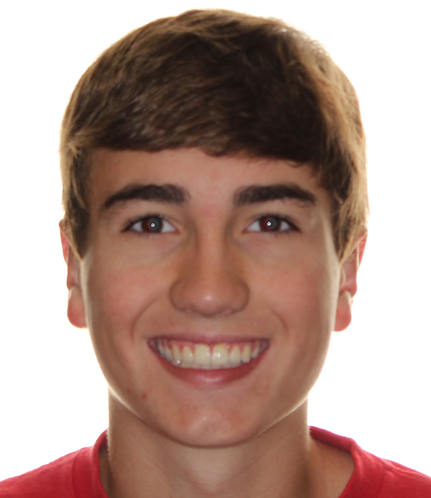 St Clair Orthodontics, Damon braces, Invisalign: Before and After: Ty ...