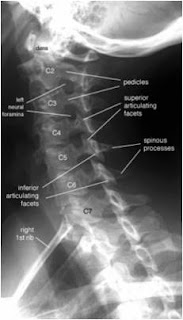 TEKNIK RADIOGRAFI CERVICAL