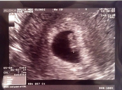 our little precious one..: 6 weeks: First Prenatal Checkup