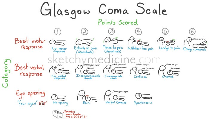 Glasgow Coma Scale ( GCS ) - Be a Nurse