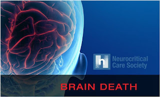 BRAIN DEATH - Anesthesia - Anesthesiology
