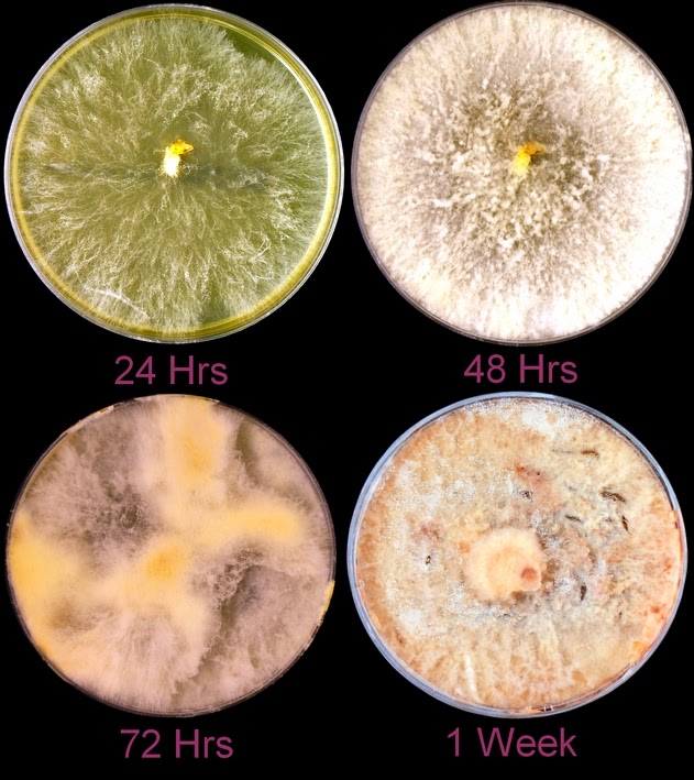 Fun With Microbiology (What's Buggin' You?): Chrysonilia sitophila