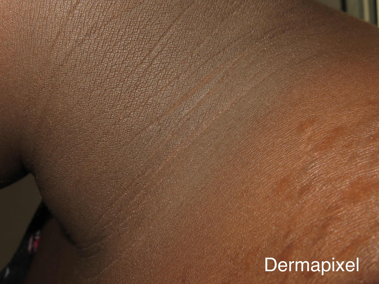 Dermapixel: mayo 2018