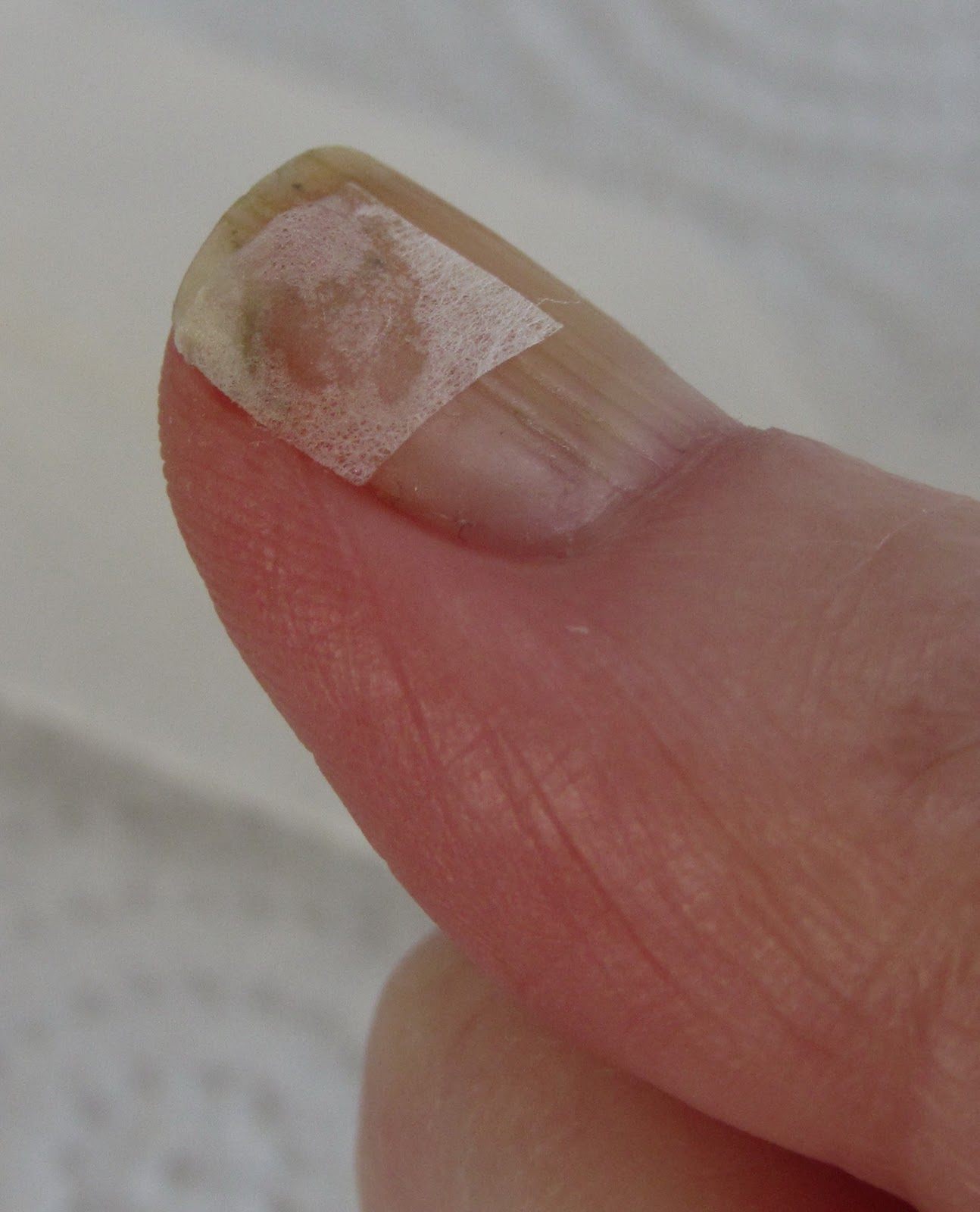 Marias Nail Art and Polish Blog: 1½ months of repairing a ripped/torn ...