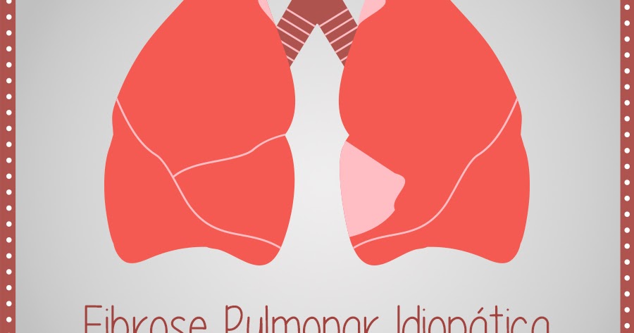 Guia Diguinho de Saúde: Fibrose Pulmonar Idiopática