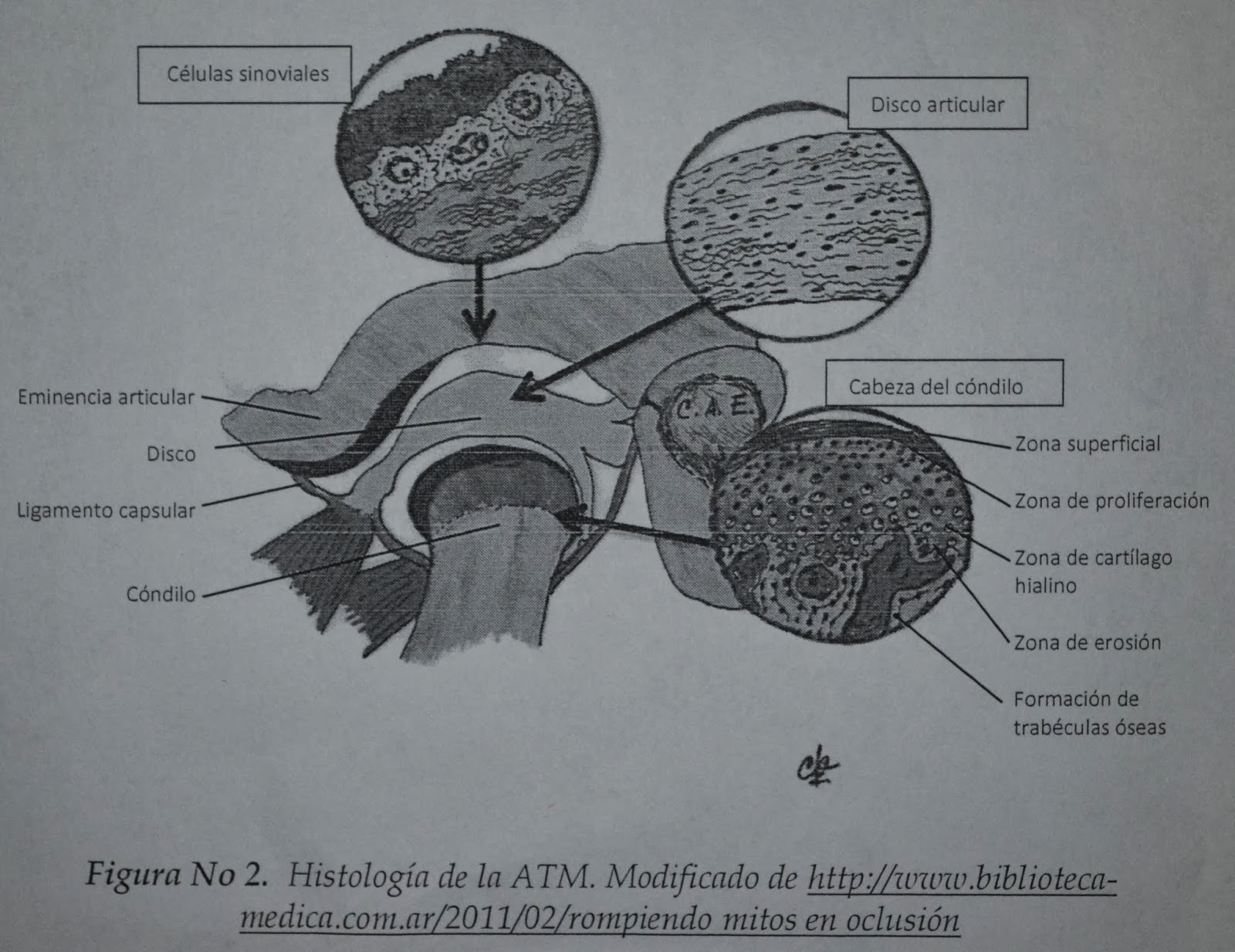 Orthodontics Team: ANATOMÍA CLÍNICA DE LA ARTICULACIÓN ...