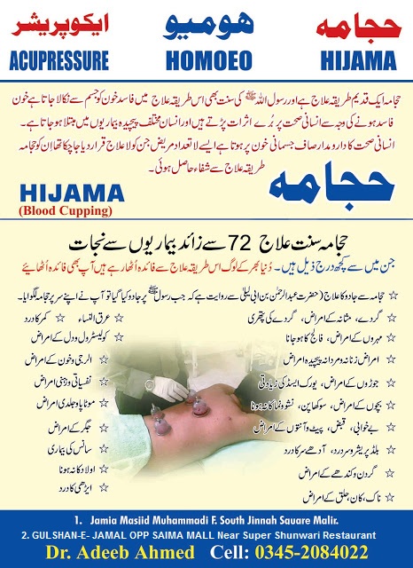 HIJAMA ( Blood Cupping ): The 10 Most Common Questions about Hijama