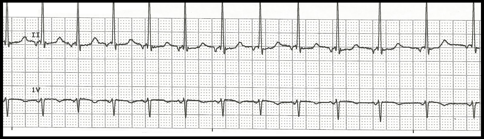 Practice EKG Rhythm Strips 184